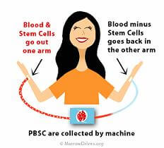 Donate Stem Cells, Save Someone’s Life (Video)