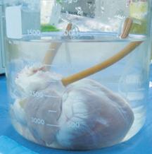 Harvard Starts Heart Outside Body, Preserves Organs for 10 Days