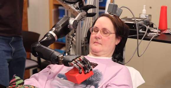 Cyborg Future Draws Closer As Woman Controls Robotic Arm With Brain Implant
