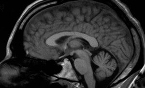 New 3D Brain Map 50 Times More Detailed Than Previous Maps