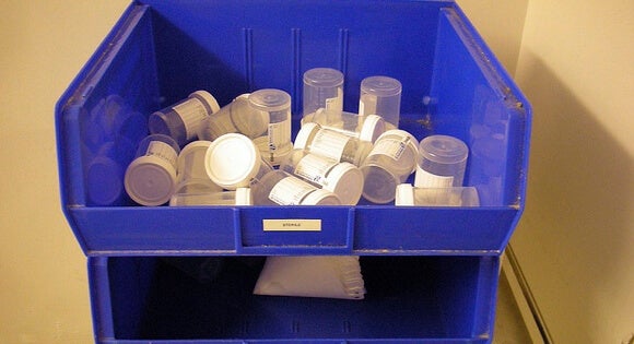 Smelling Cancer: Device Detects Bladder Cancer From Odor of Urine