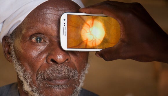 Will Peek's Mobile Eye Exam System Take a Bite Out of Developing World ...