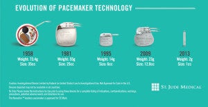 Pacemaker Okayed in Europe Is One-Tenth the Size of Those Used Now