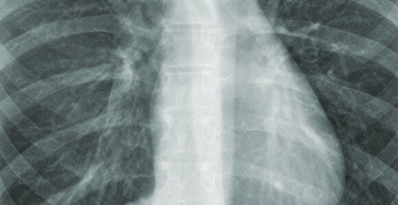 X-Ray App Assists Doctors In Diagnosing Rare Conditions