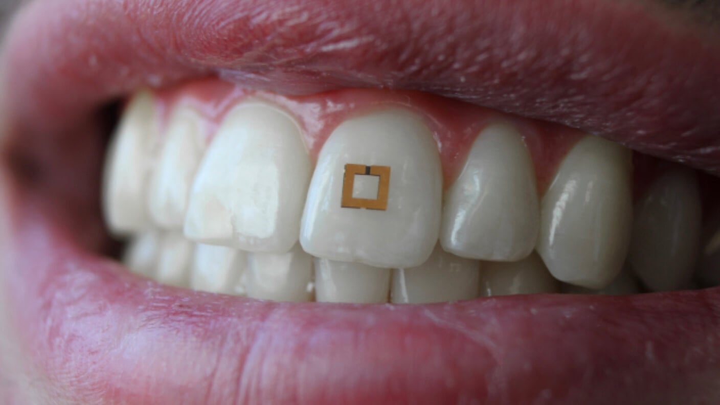 Tiny Tooth Sensor Tracks What You Eat, and It Could Help You Be Healthier