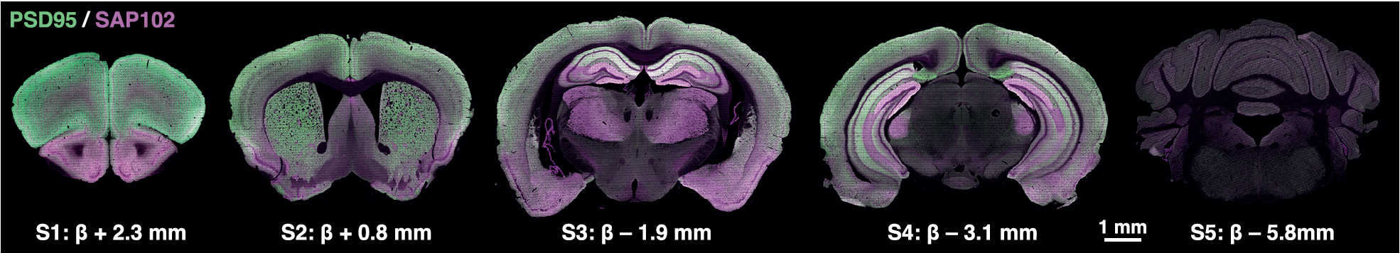 Amazing New Brain Map of Every Synapse Points to the Roots of Thinking