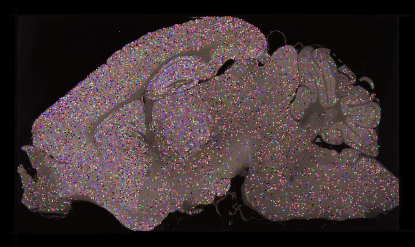 Amazingly Detailed Map Reveals How the Brain Changes With Aging