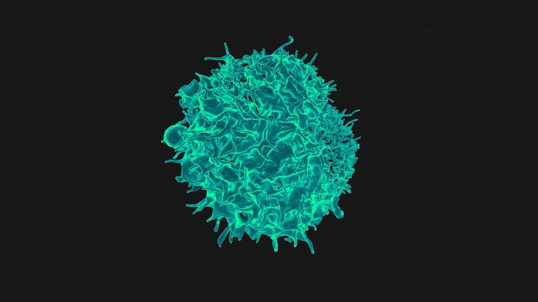 These Engineered Cells Are Super Soldiers That Hunt Down Cancers