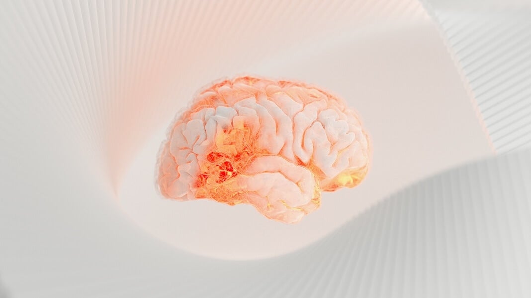 Surgeons Are Simulating Whole Brains to Pin Down the Source of Their ...