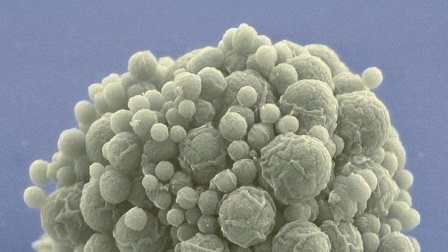 Synthetic Cells Stripped of Nearly All Their Genes Still Thrive Under ...