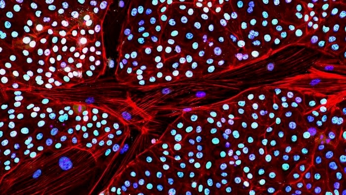 Colossal Creates Elephant Stem Cells for the First Time in Quest to ...