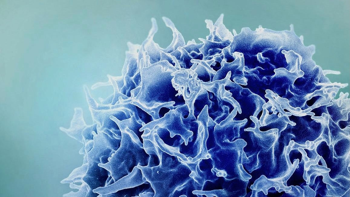 Cell Therapy Takes Aim at Deadly Brain Tumors in Two Clinical Trials
