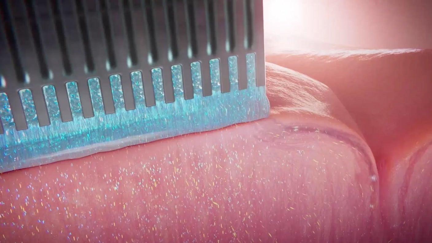 Neuralink Rival’s Biohybrid Implant Connects to the Brain With Living ...