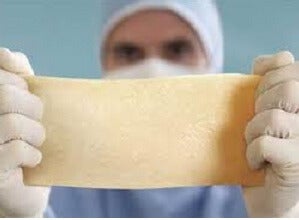 Alloderm Allows you to Grow New Skin