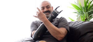 Bebionic Prosthetic Hand Continues To Amaze In Latest Video