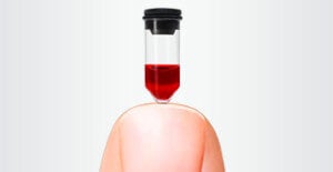 Small, Fast and Cheap, Theranos Is the Poster Child of Med Tech -- and ...