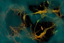 Lab-Grown Neurons Deliver a Real-Time Glimpse Into How the Brain Works
