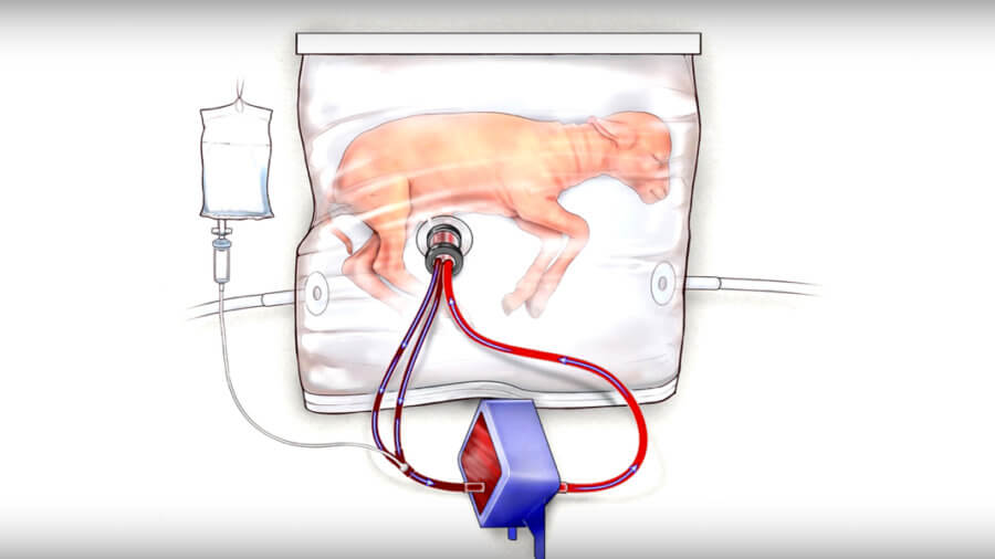 Scientists Create the Most Successful Artificial Womb Yet