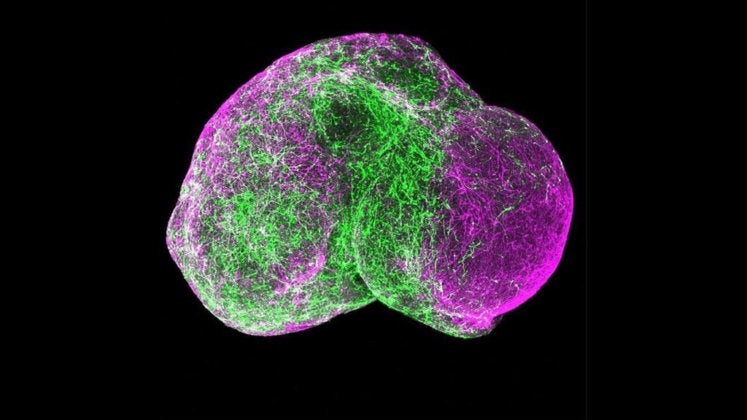 Bizarre Mini Brains Offer a Fascinating New Look at the Brain