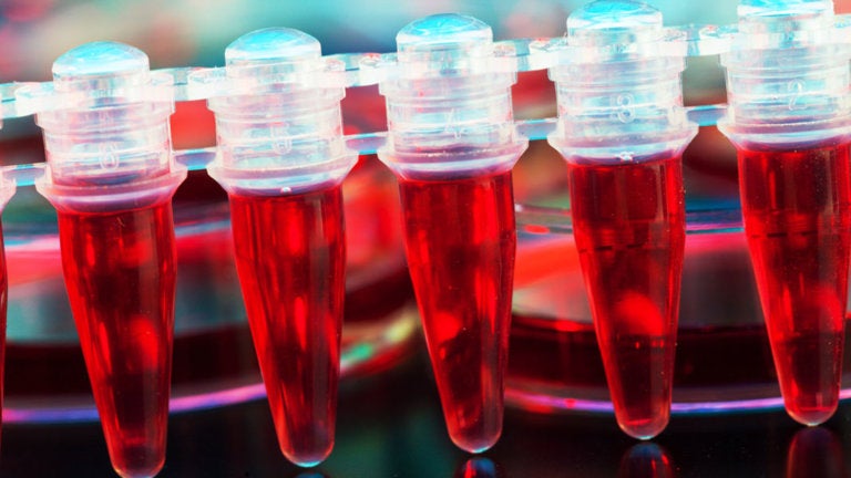 Limitless Lab-Grown Blood Is 'Tantalizingly Close' After 20 Years