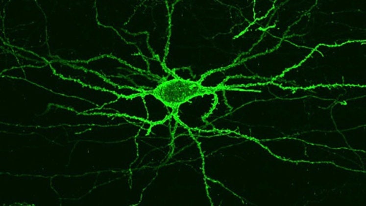 This Sensor Lets Scientists See Neuron-Level Brain Activity in Real Time
