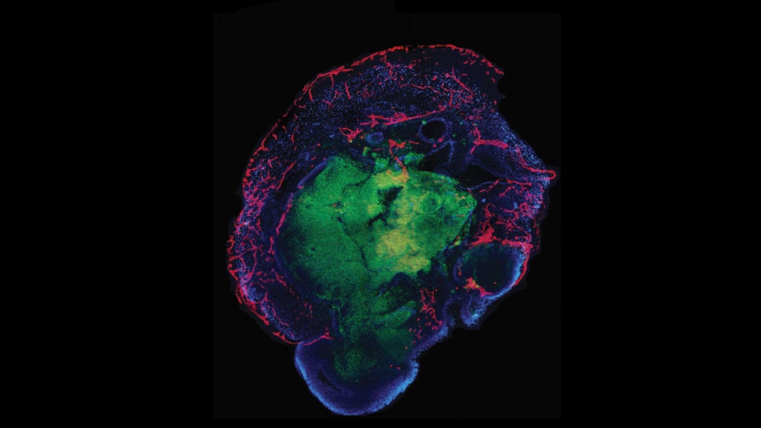 Mini-Brains Just Grew Their Own Blood Vessels—Here's Why That's Great News