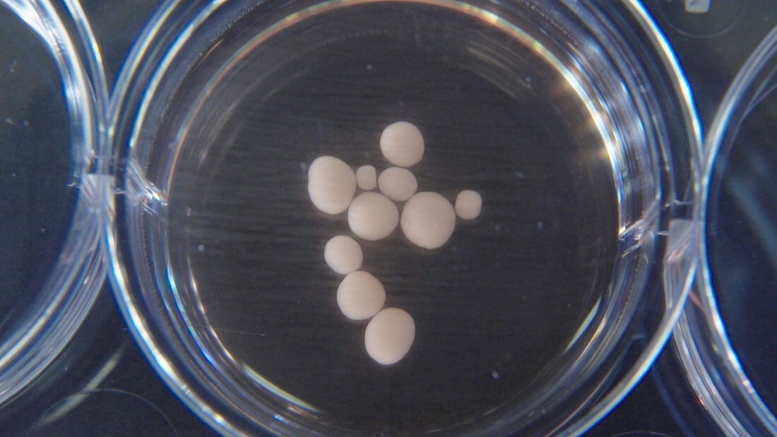 Lab-Grown Minibrains Show Activity Similar to Babies' Brains