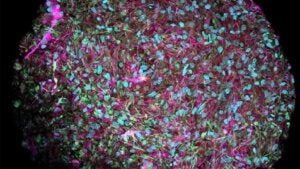 Biocomputing With Mini-Brains as Processors Could Be More Powerful Than ...